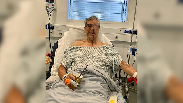 Injured cyclist gets 3D face printed after crash with drunk driver