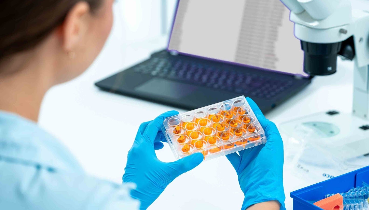 Novartis agrees to buy Avidity Biosciences for $12bn