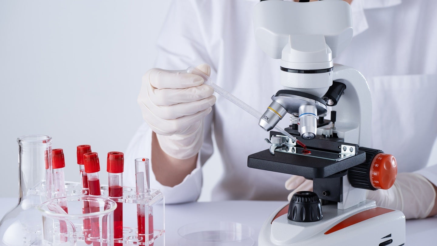 NHS trials rapid blood test to diagnose serious infections in children