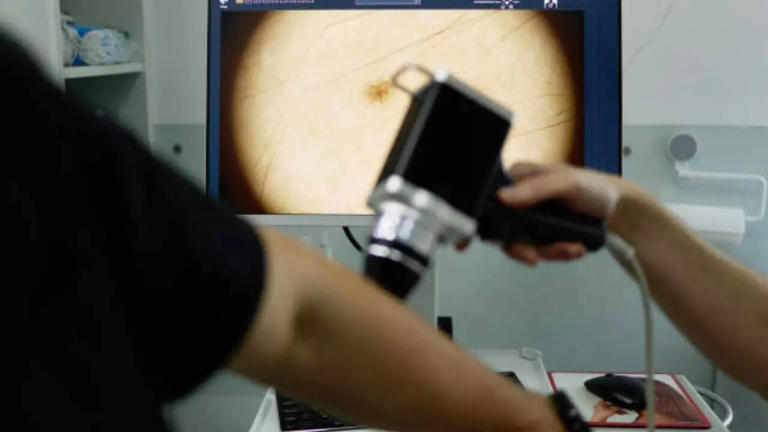 Going grey? It might be your body’s secret weapon against cancer, says study