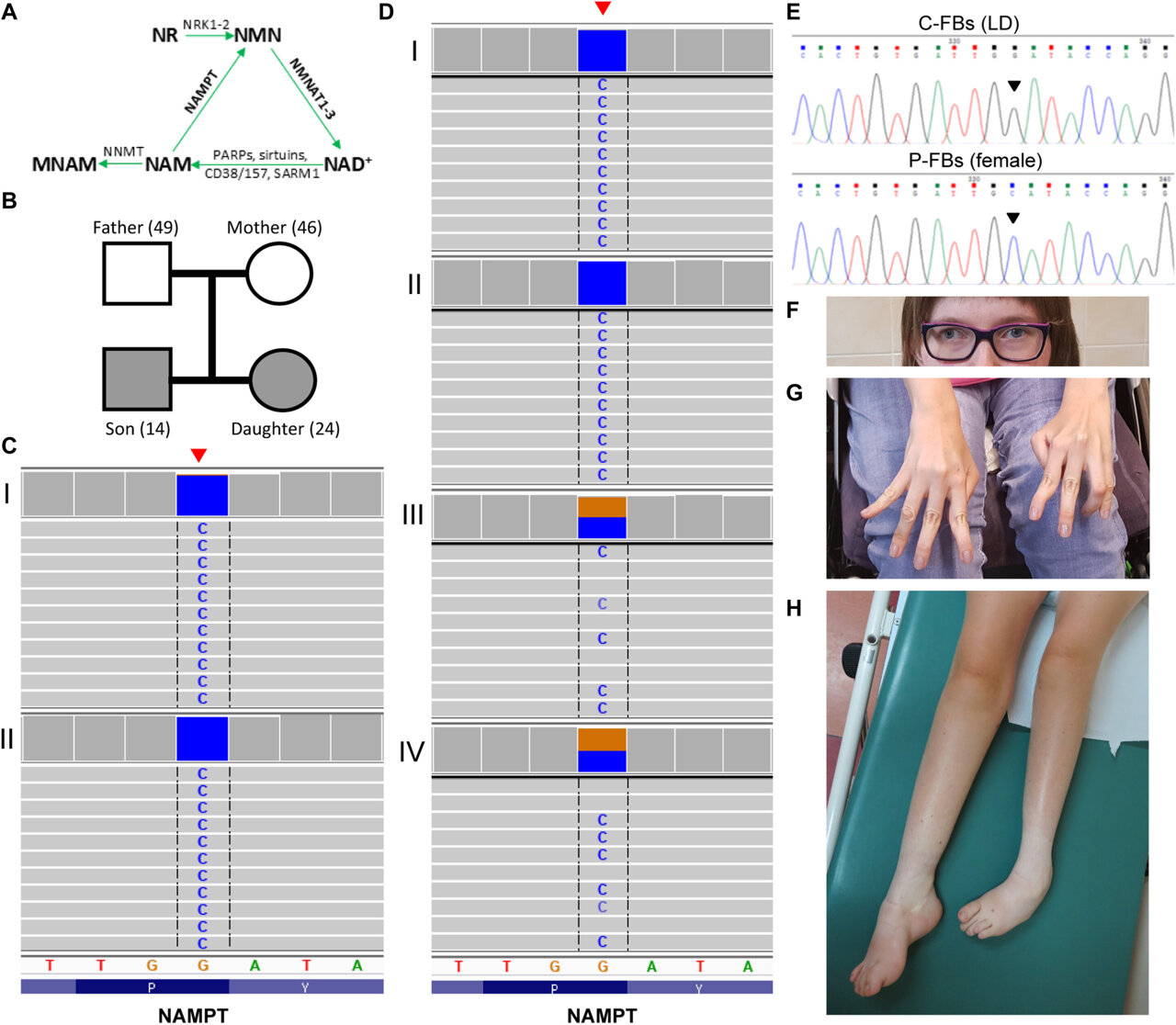 New rare genetic disease affecting motor neuron and muscle control ...
