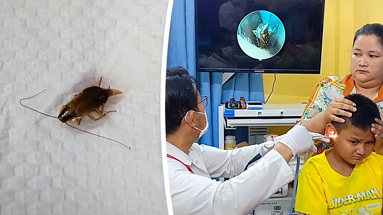 Doctor pulls live cockroach out of young boy's ear in Cambodia
