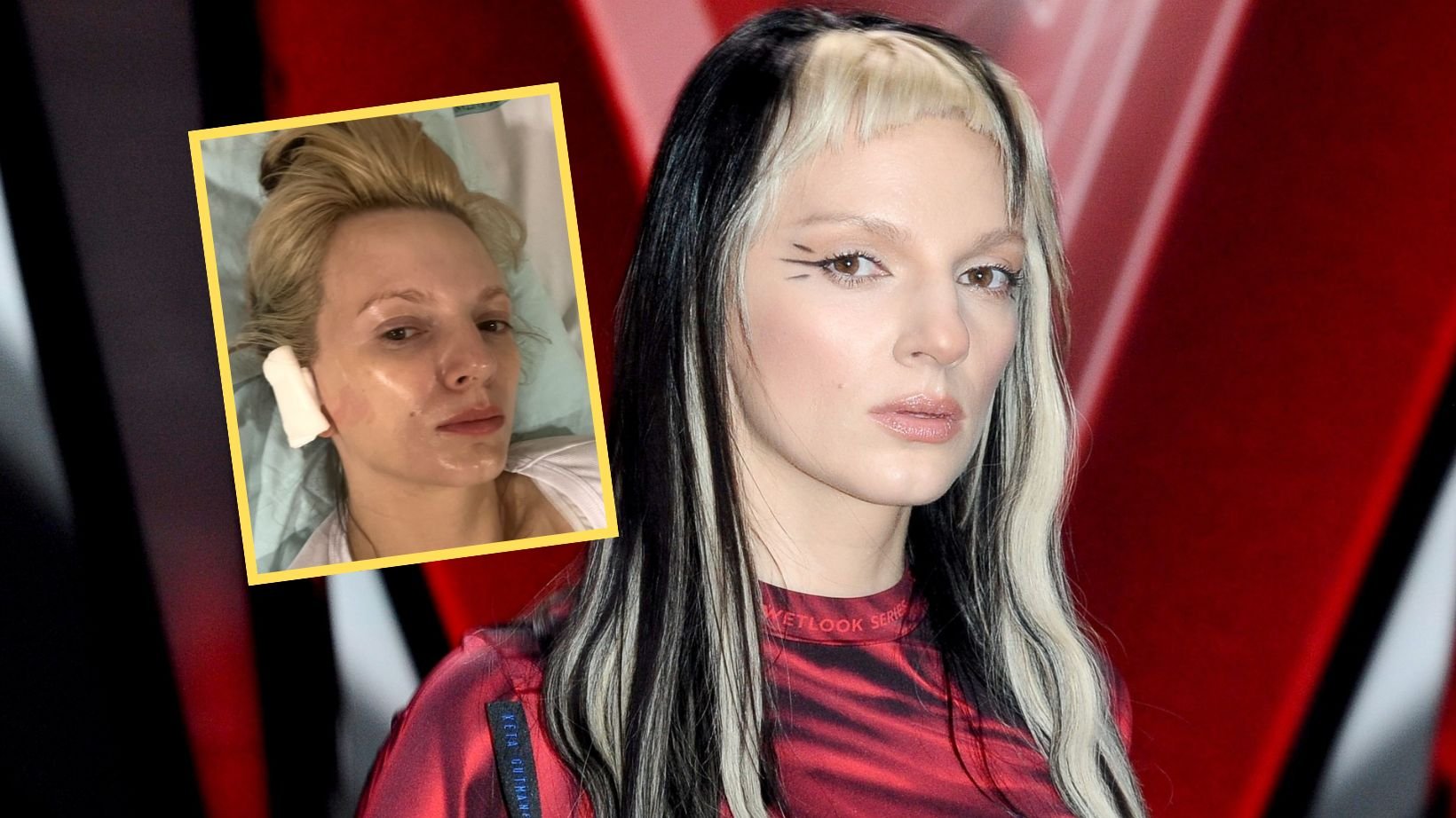 Sarsa od kilku lat zmaga się z otosklerozą. Teraz wyznała, że choroba ...