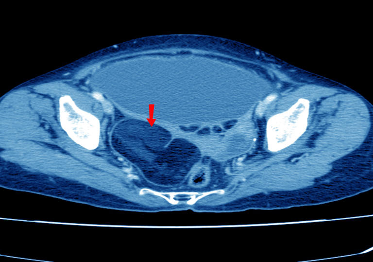 17 Wild Facts About The Human Body That I Absolutely Promise You Never ...