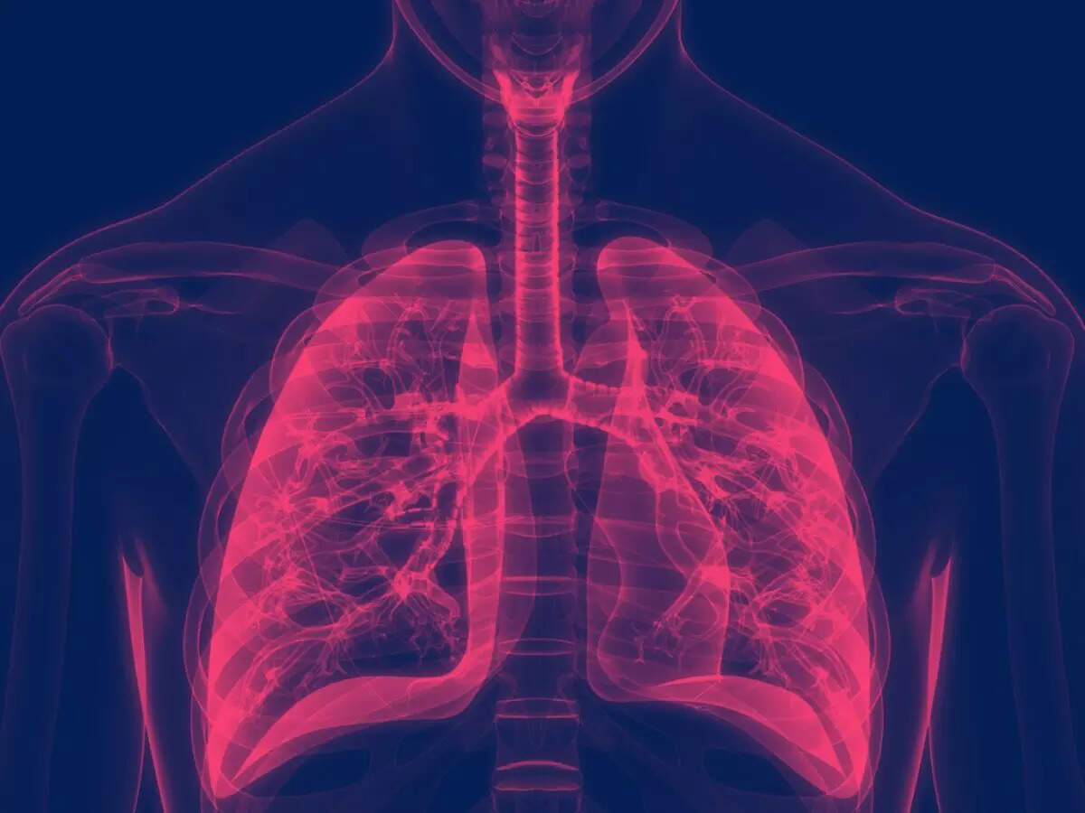 6 foods that can worsen lung function and raise cancer risk