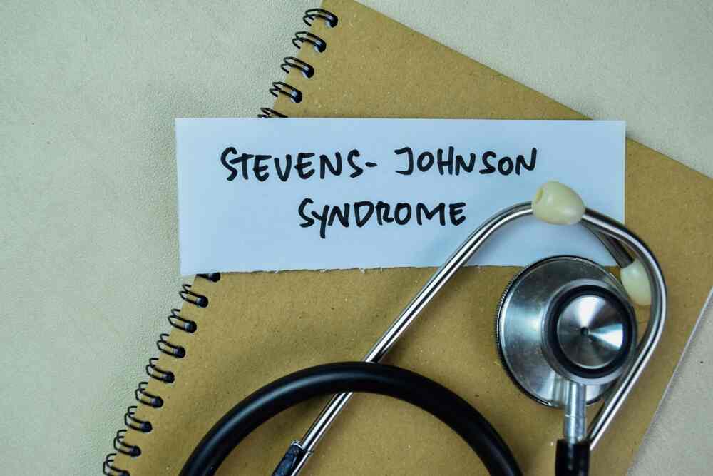 Stevens-Johnson Syndrome: Causes, Symptoms, Diagnosis, Treatment