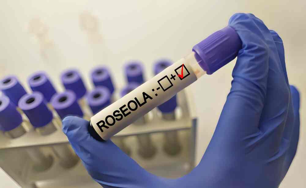 Roseola: Causes, Symptoms, Diagnosis, Treatment and Prevention