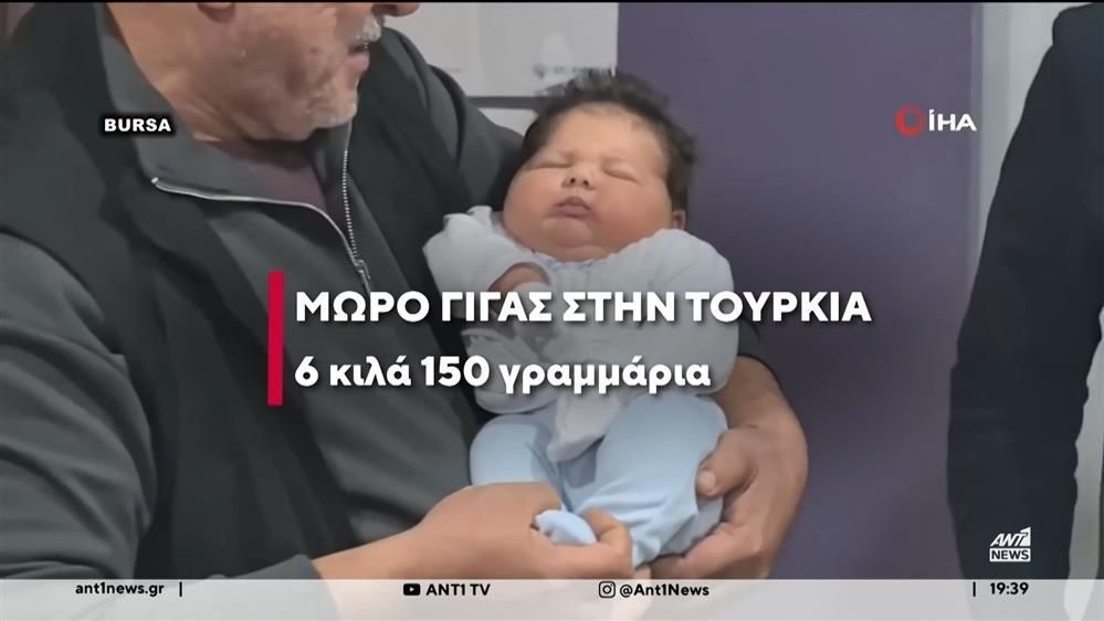 Τουρκία: Γεννήθηκε μωρό γίγας