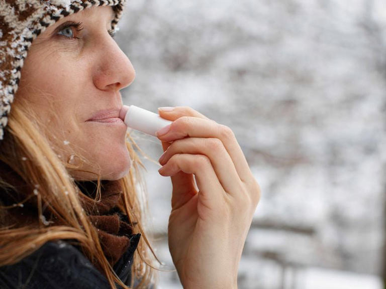 Weder Labello noch Blistex: Die beste Marke für Lippenpflege laut ...