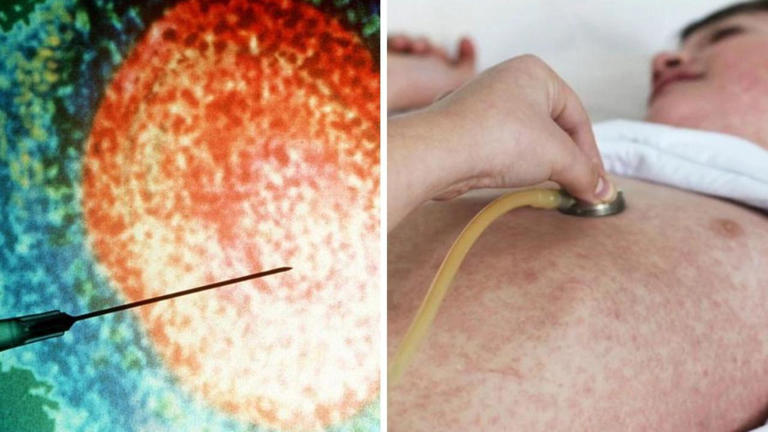 Urgent alert as disease outbreak grows