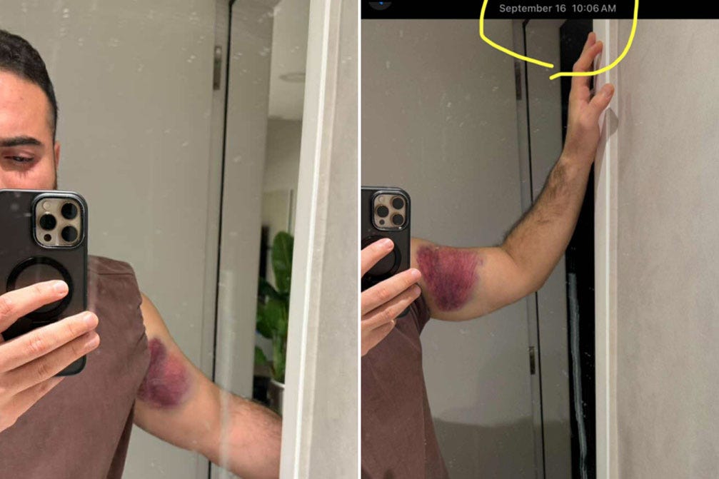 Hamdy Abdelwahab reveals being severely compromised in lopsided UFC 321 win