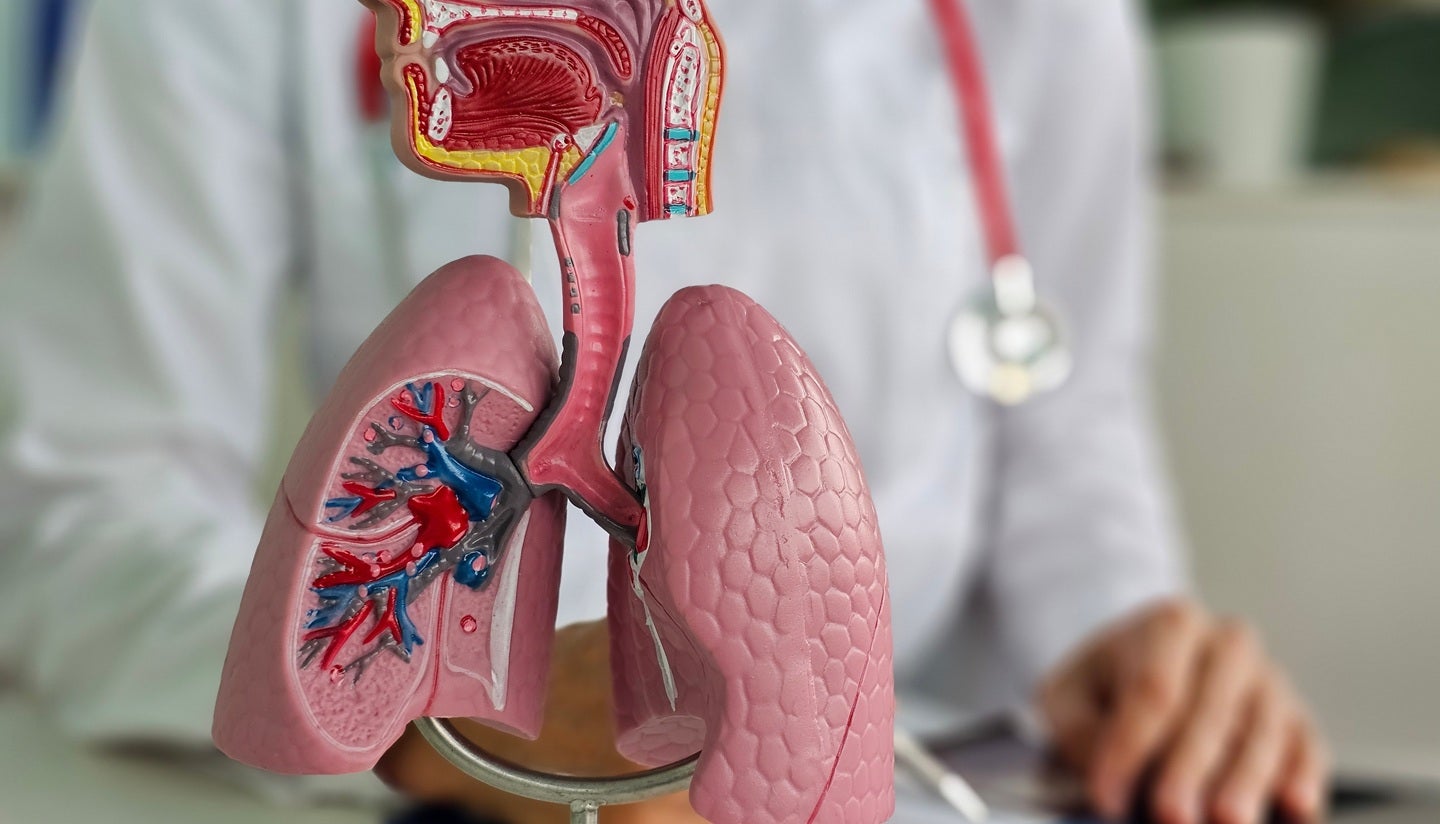 Edesa Biotech reports positive Phase III results for ARDS treatment