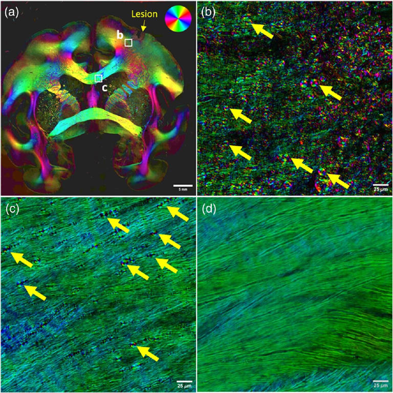 Highly sensitive imaging technique detects myelin damage