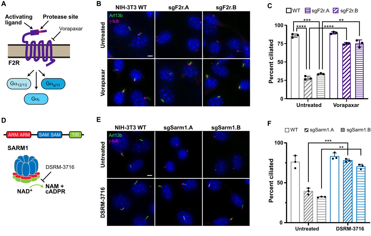 Pathway provides new insight into how cilia on cell surfaces break down ...