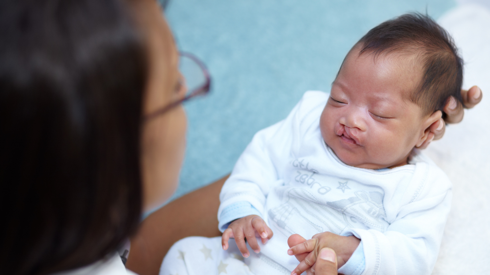 Caring for a Baby with Cleft Lip or Palate - Diagnosis and Treatment