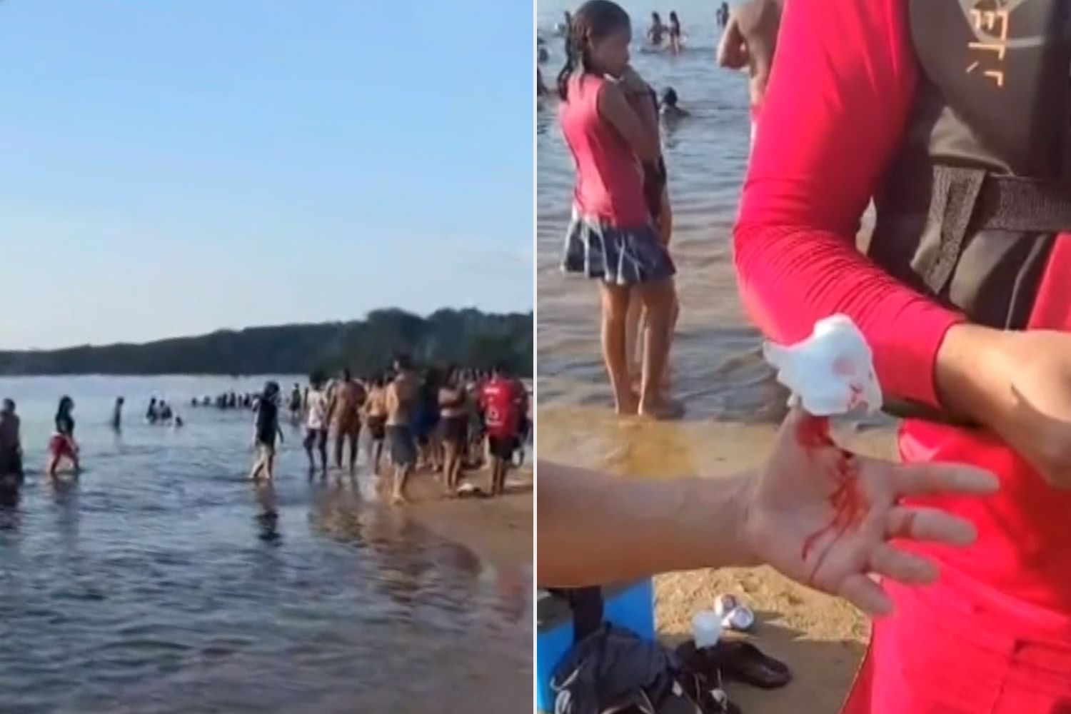 7-Month-Old Baby Reportedly Loses Part of Their Toe After Piranhas ...