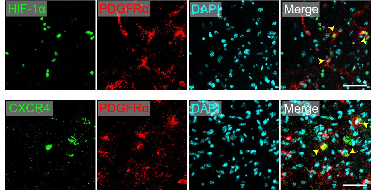 Immature brain-supporting cells switch fate to restore blood flow after ...