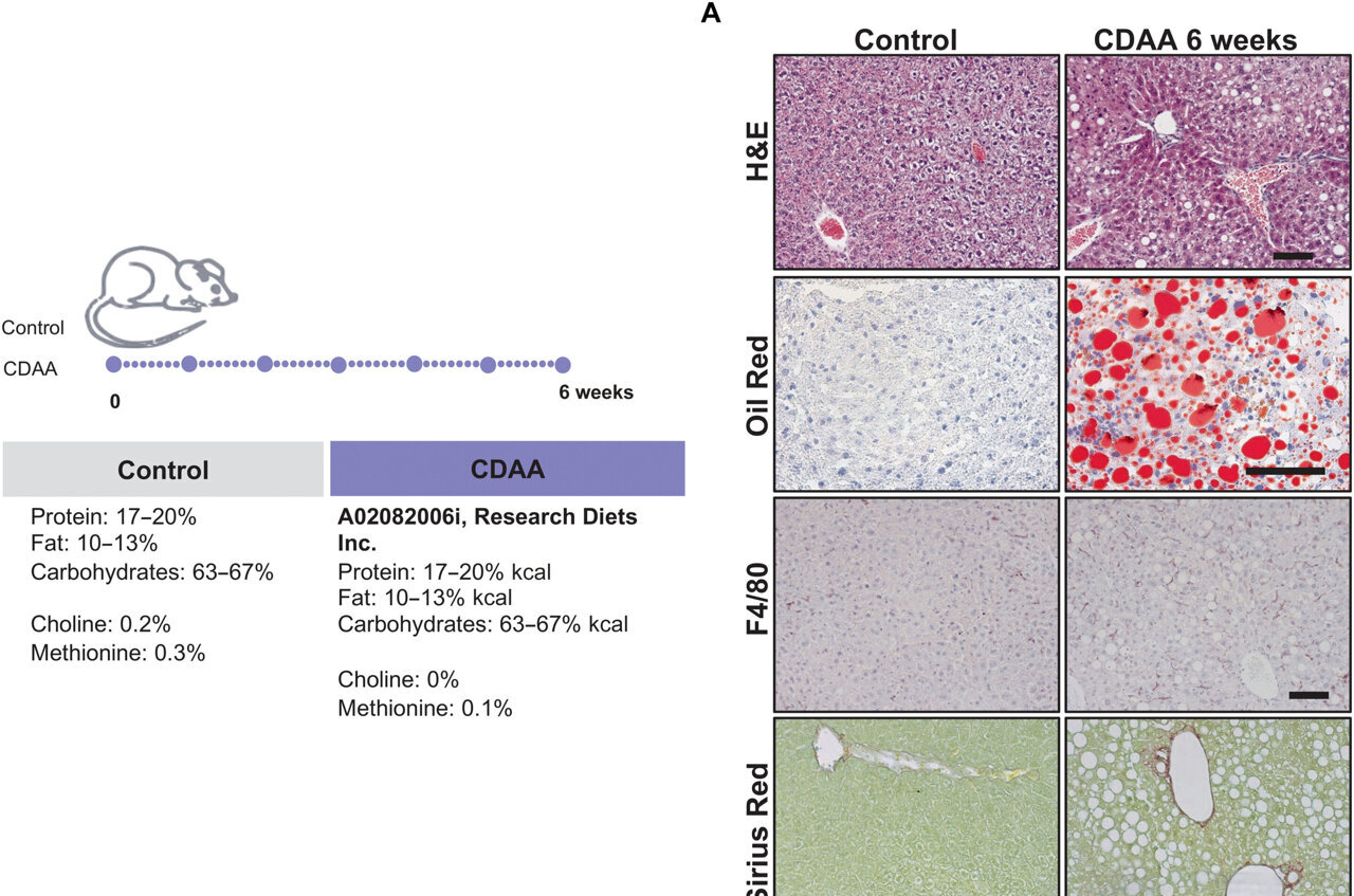 Connection between liver and brain in the context of metabolic liver ...