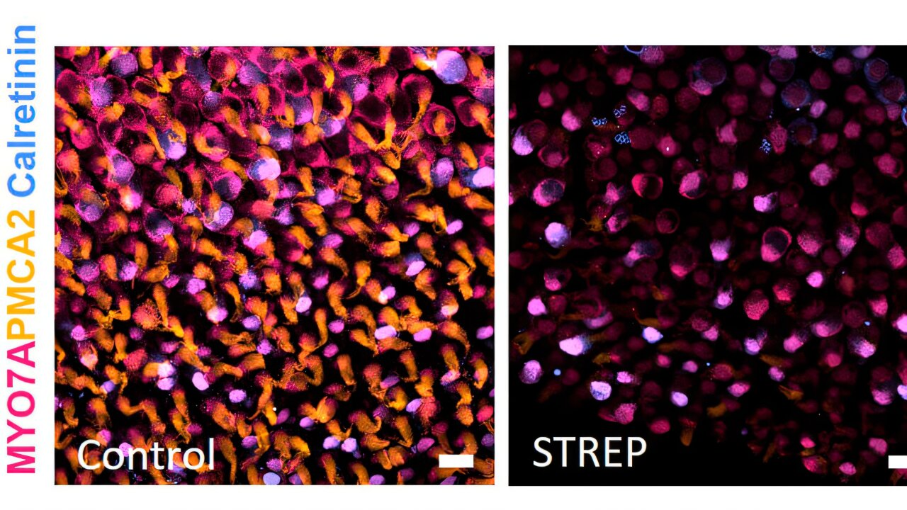 Genetic mechanisms reveal how toxic substances damage balance cells in ...