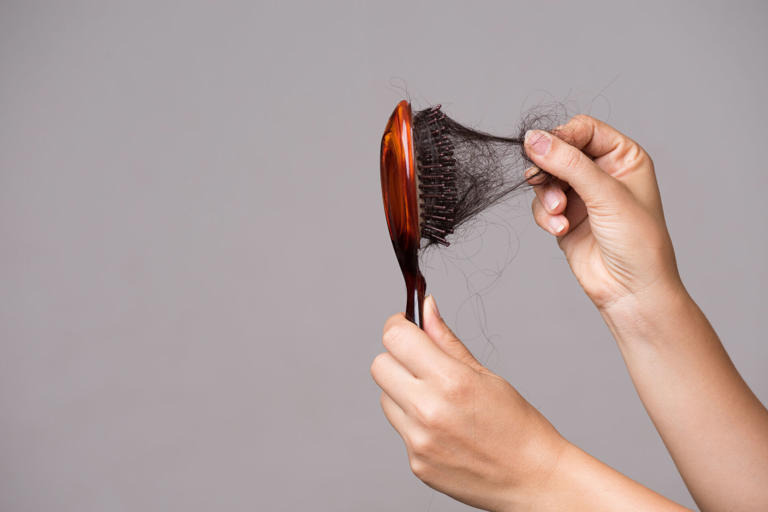 8 hair loss triggers you might not be aware of, according to a trichologist
