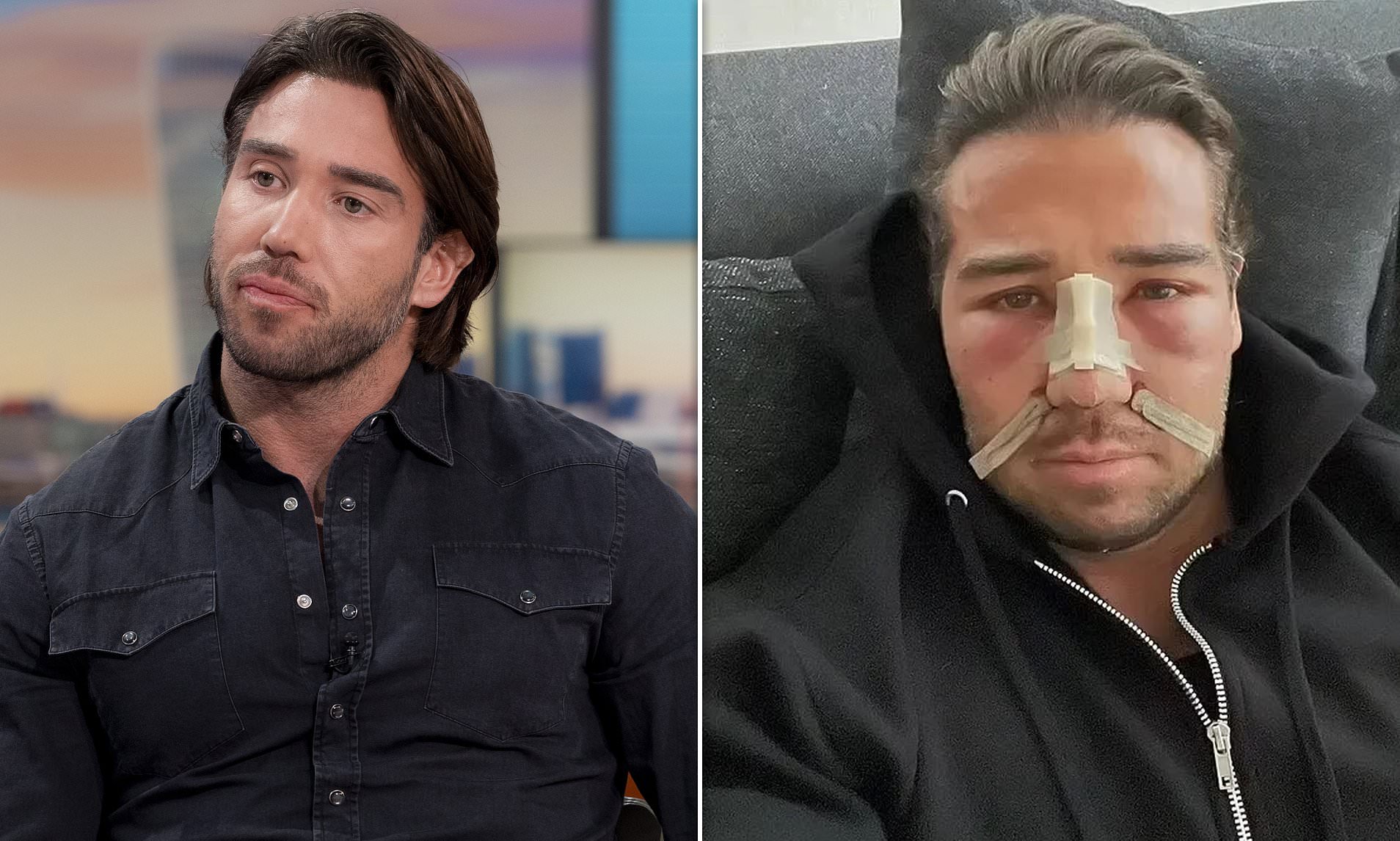 TOWIE's James Lock, 38, spent £100K on cosmetic surgery amid ...