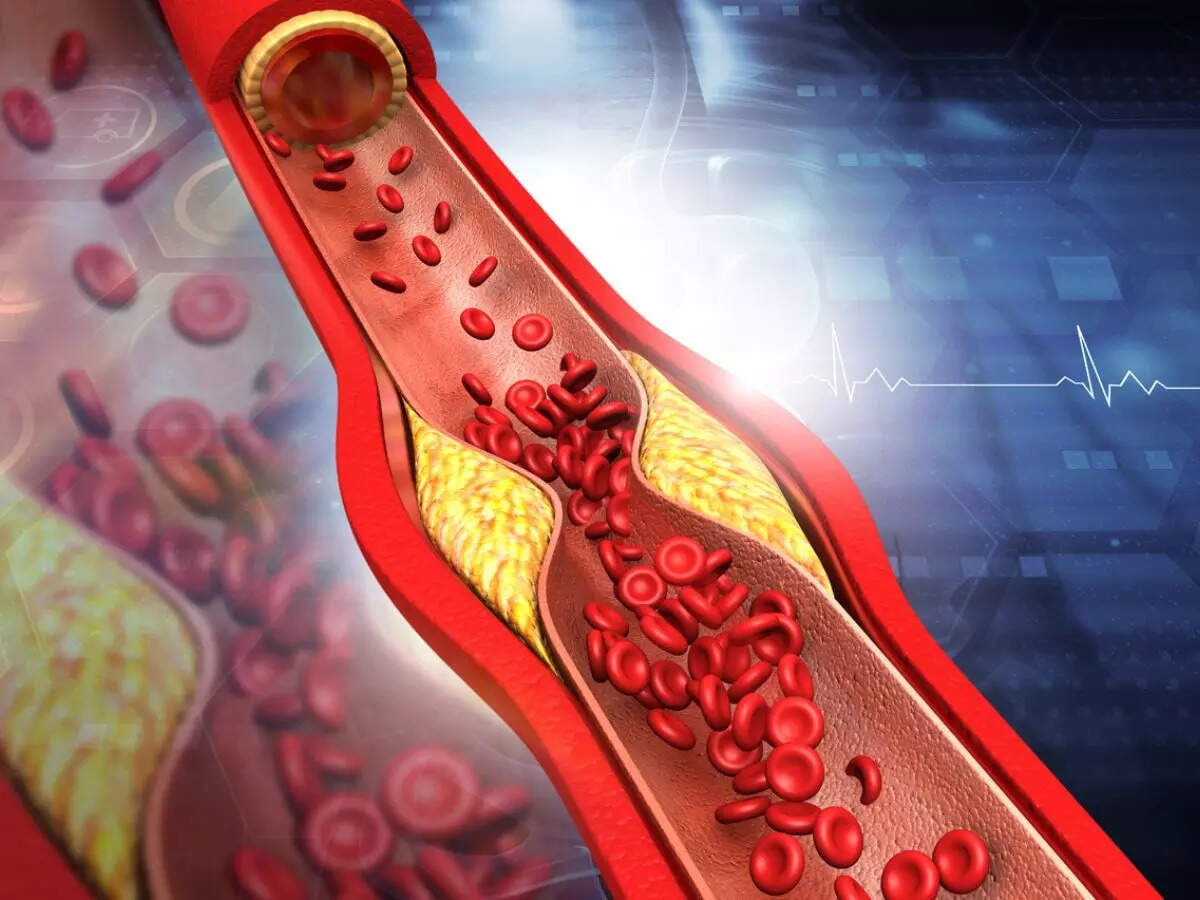 Heart health: 5 things that can trigger a heart attack