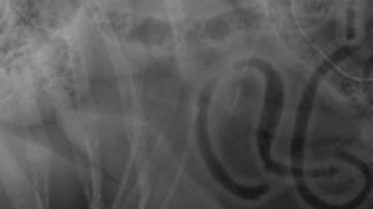 German Shepherd feels unwell and the vet takes an X-ray to see ...