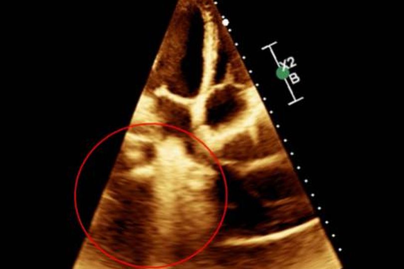 Limerick doctors use one of Ireland's fave fizzy drinks in unusual ...