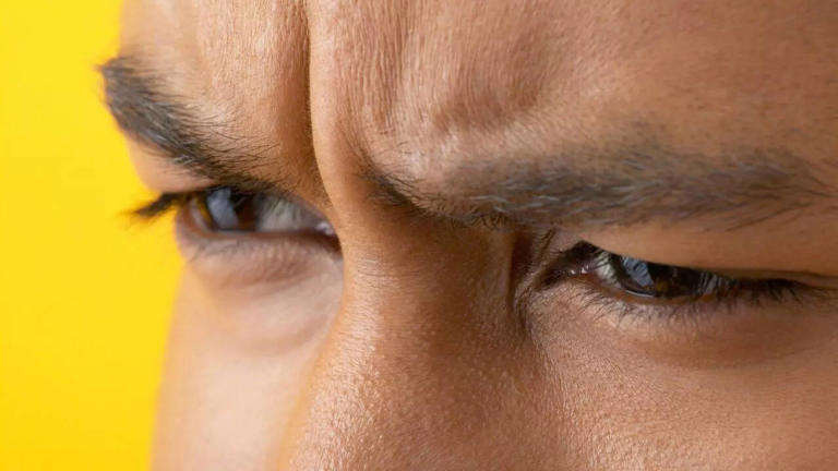 6 Facial exercises to reduce frown lines: A natural method to soften ...