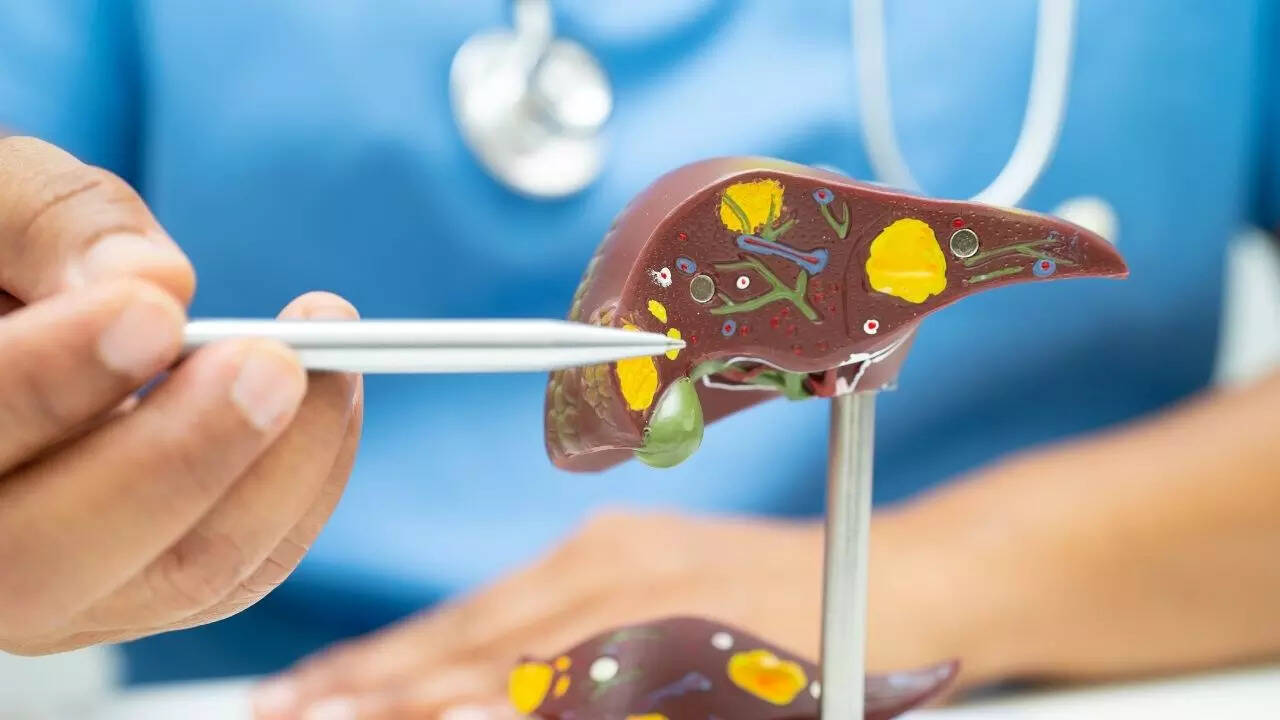 Reverse fatty liver naturally in 90 days: Here are 3 things to focus on