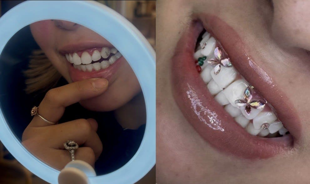 Tooth Gems: A trend to smile about, with a few words of caution