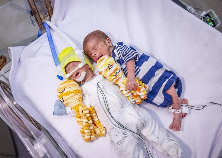 Hospital hand-crochets octopuses to comfort premature patients