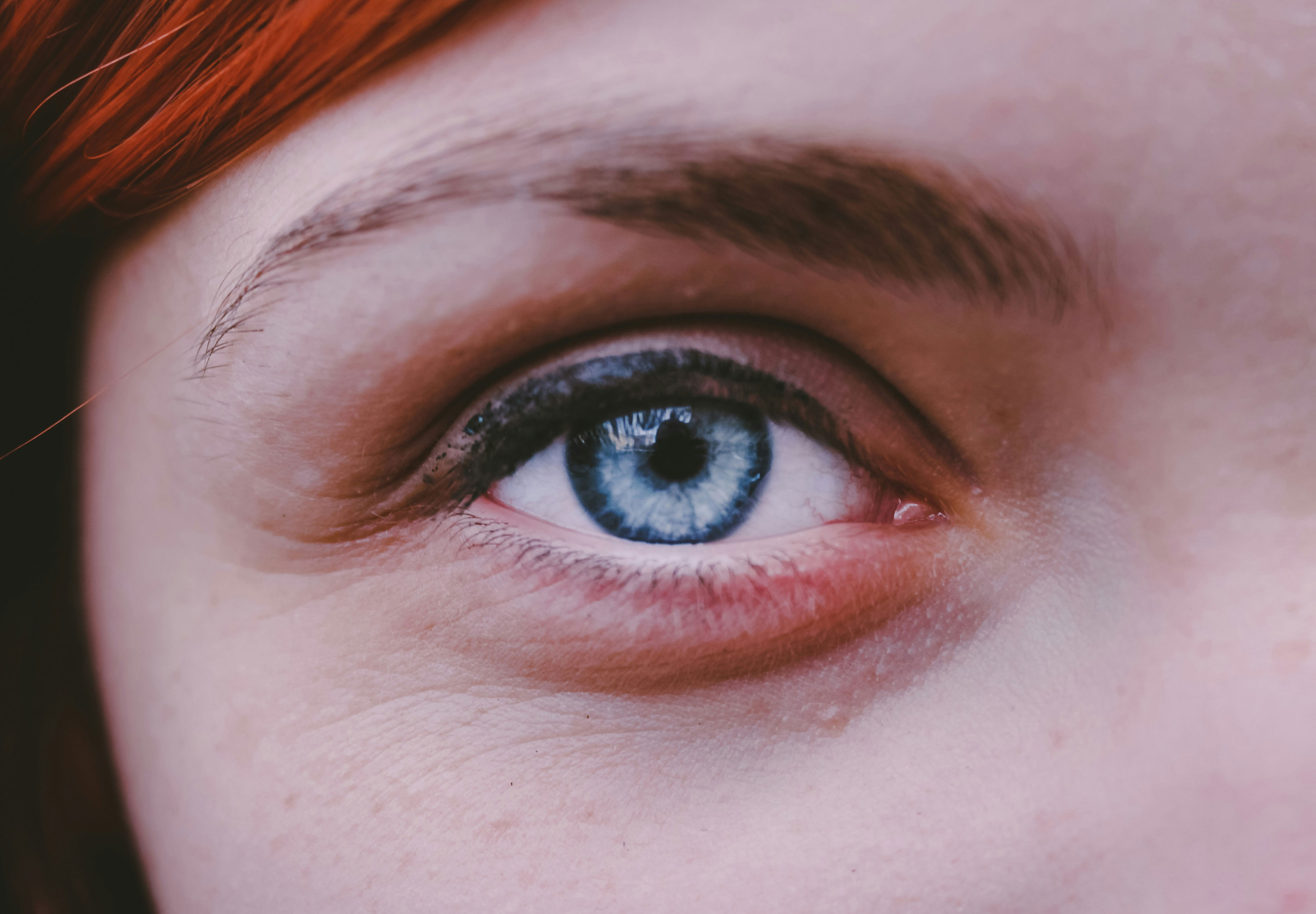 6 Foods That Cause Dark Circles Under Your Eyes