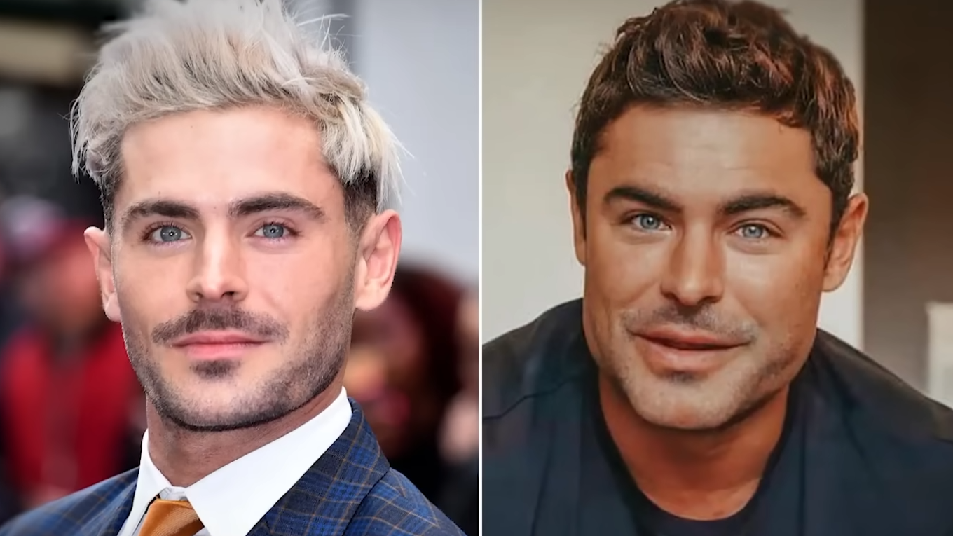 The Truth Behind Zac Efron’s Accident and Transformation