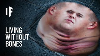 Could humans survive without bones?