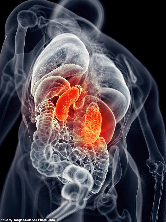 Chronic kidney disease has more than DOUBLED globally since 1990 ...