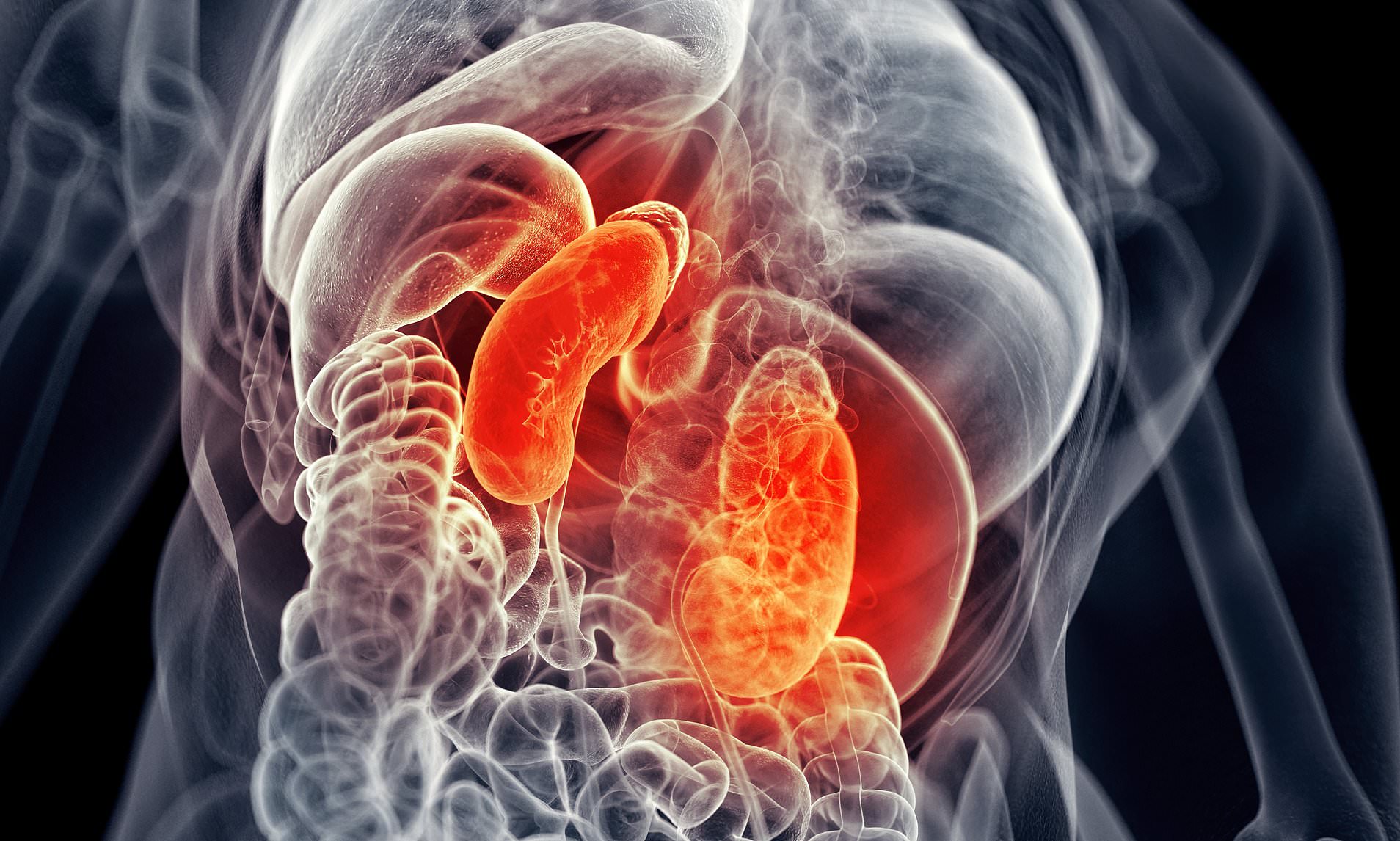 Chronic kidney disease has more than DOUBLED globally since 1990 ...