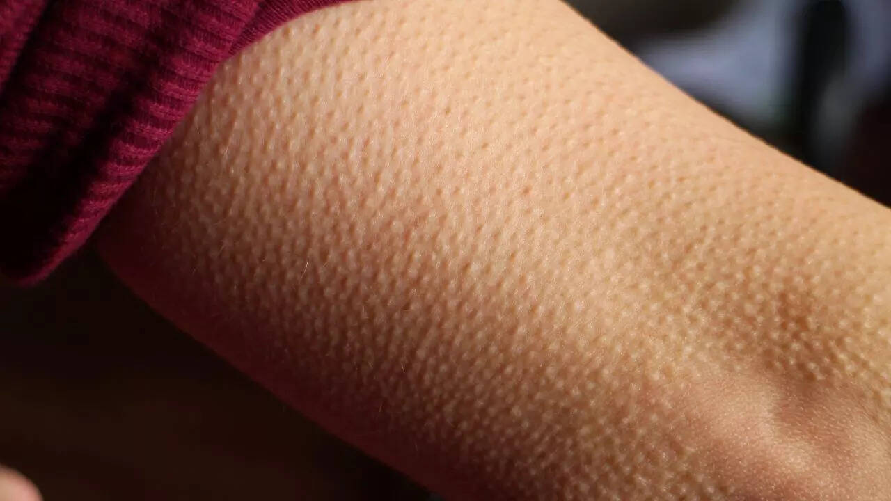 Why you get goosebumps and what research reveals about their purpose