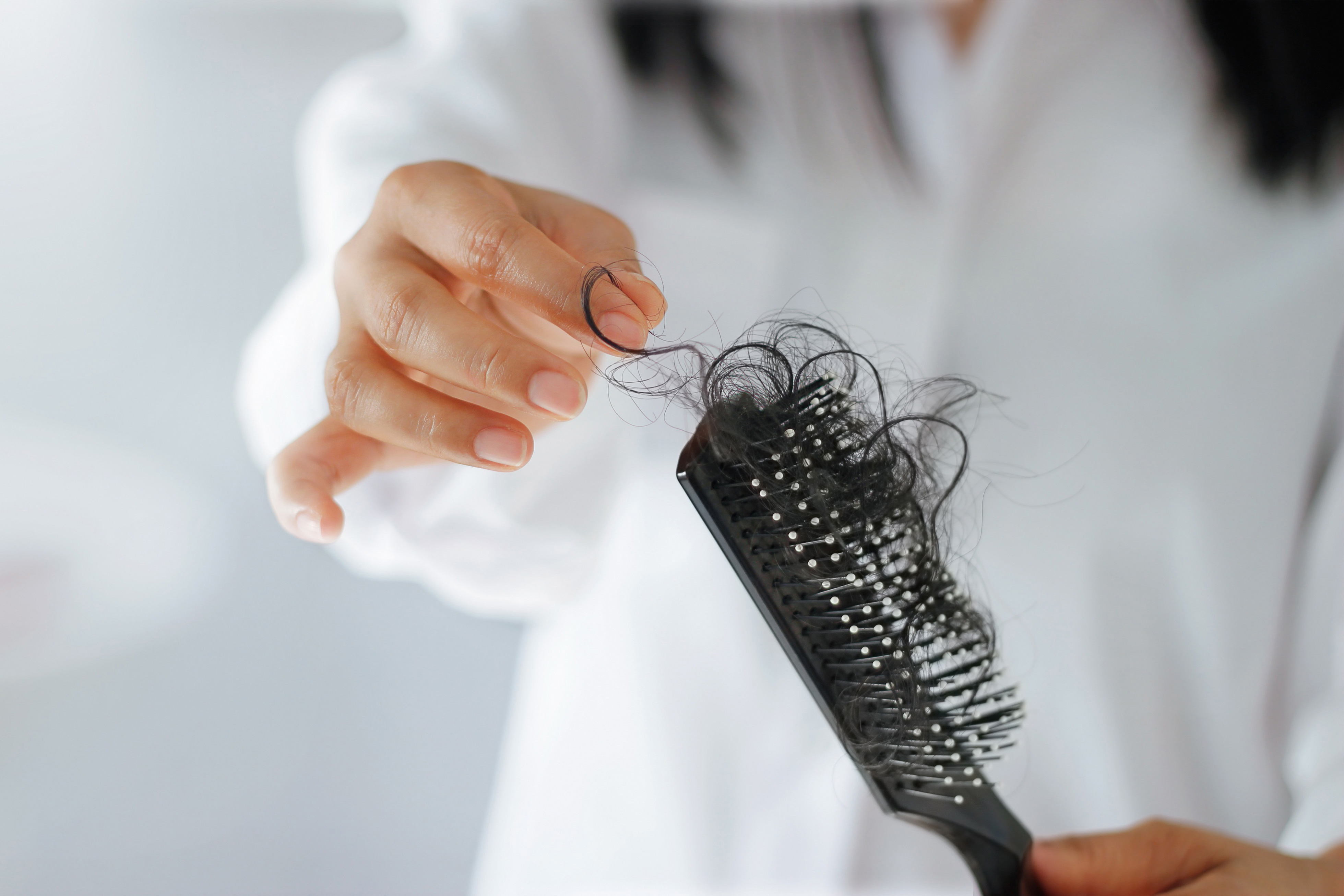 3 types of hair loss and the treatments that actually help