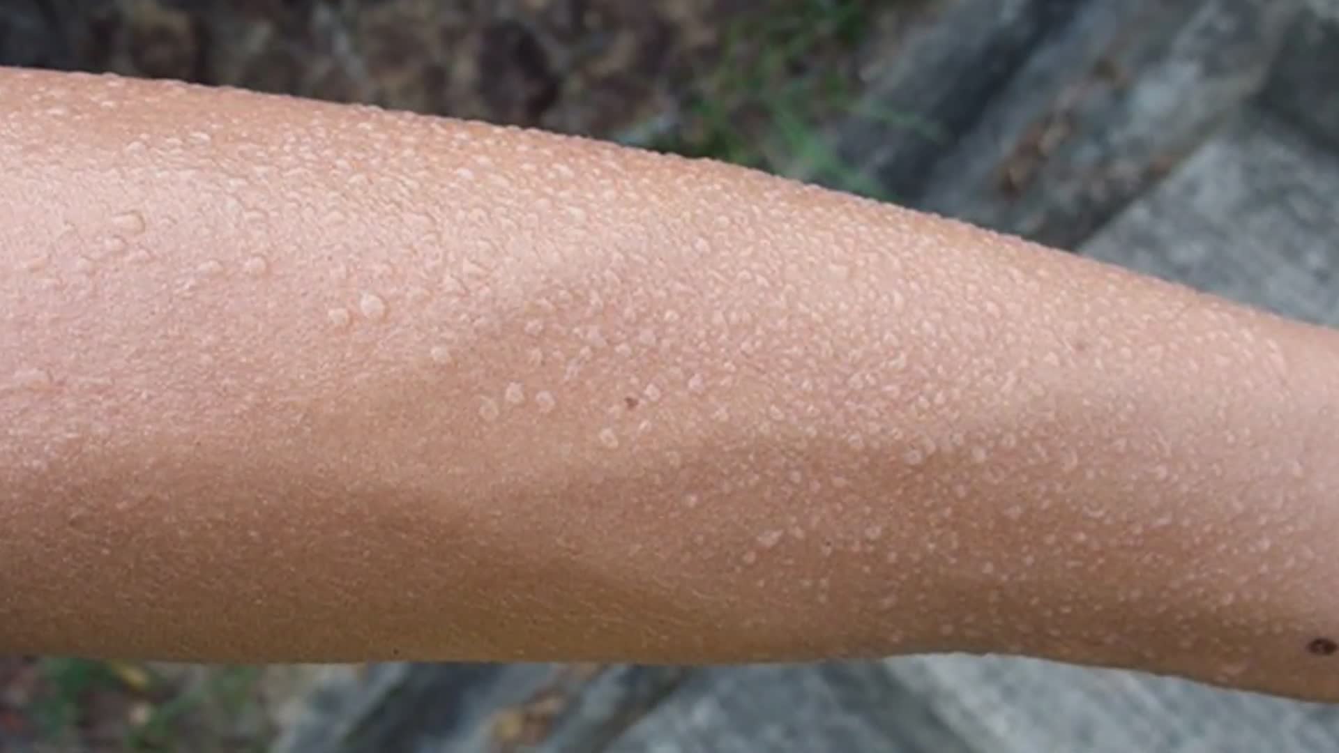 25 bacteria facts that might make you feel dirty