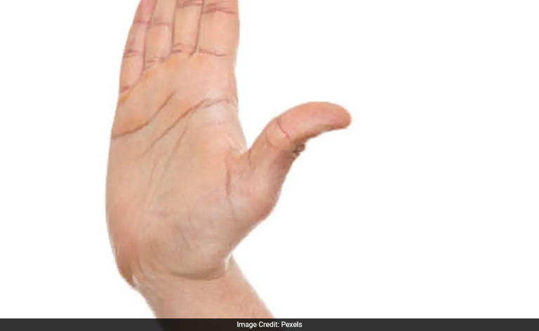 Chinese Martial Arts Star Suffers Broken Cheekbone In Global Power Slap ...