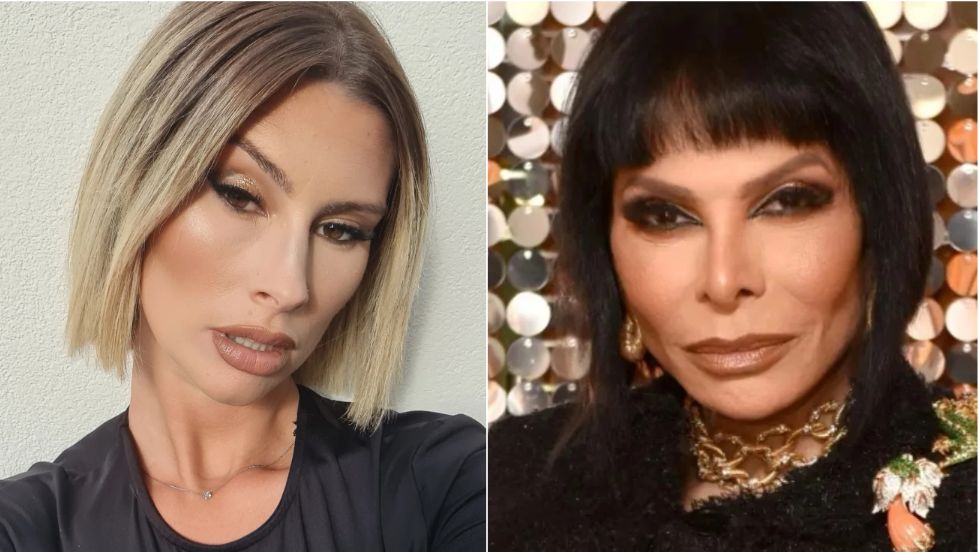 Bernardina Brito mexeu no rosto e parece... o José Castelo Branco?