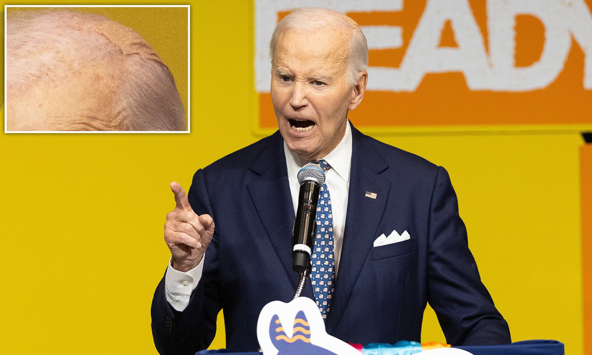 Joe Biden, 82, appears with a bandaged head to give fiery speech as he ...