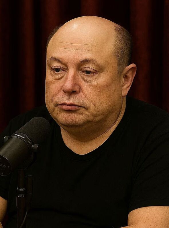 AI reveals shocking image of Elon Musk 'without hair transplants or ...