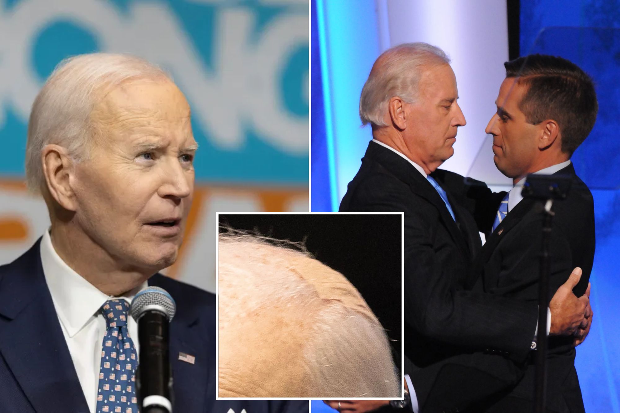 Bandaged-up Biden says son Beau ‘should’ve been the president, not me ...
