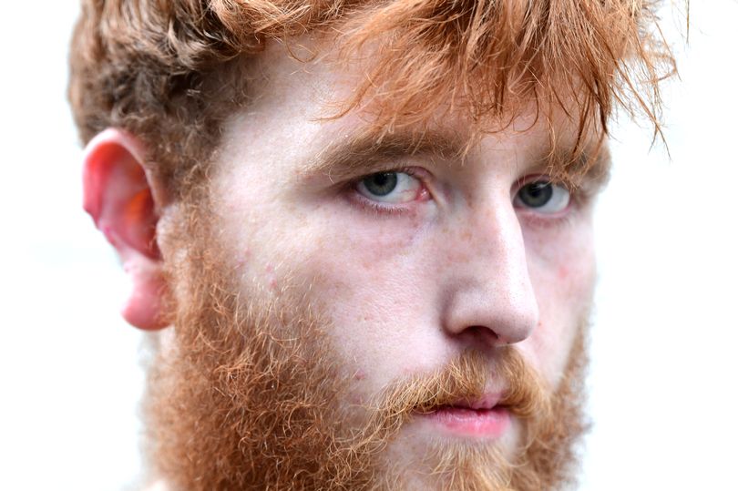 Why are so many people getting their ears bitten off?