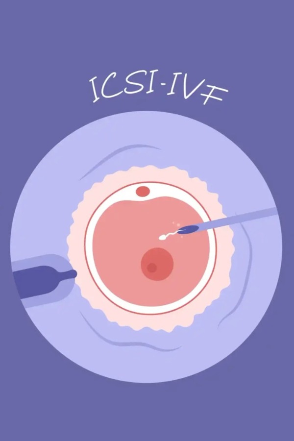 ICSI vs Conventional IVF: Which is More Effective for Male Infertility?