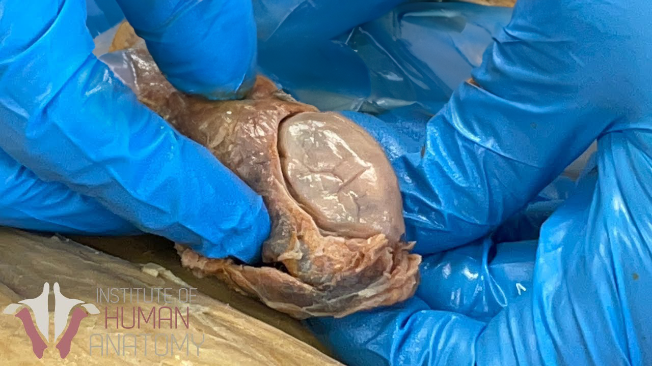 Male Birth Control Explained: The Vasectomy