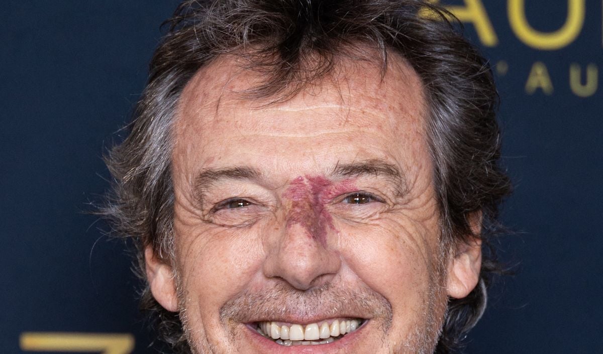 Même sourire et même regard... Jean-Luc Reichmann partage une rare ...