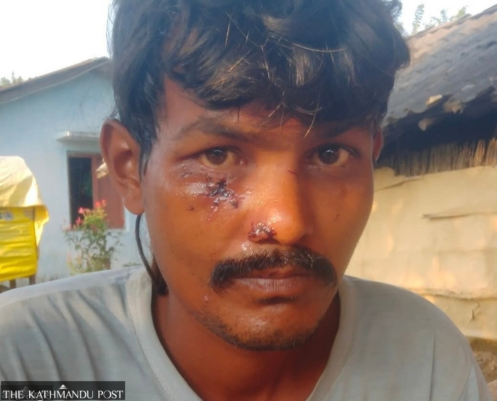 Monkey attack injures 14 people and one cow dead